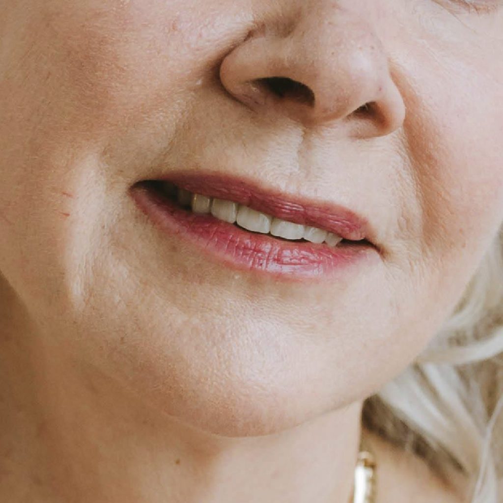 Resurfacing Benefits of Skin Needling - Results Laser Clinic
