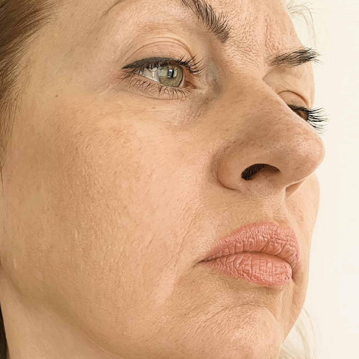 Understanding Skin Conditions and Their Treatments - Results Laser Clinic